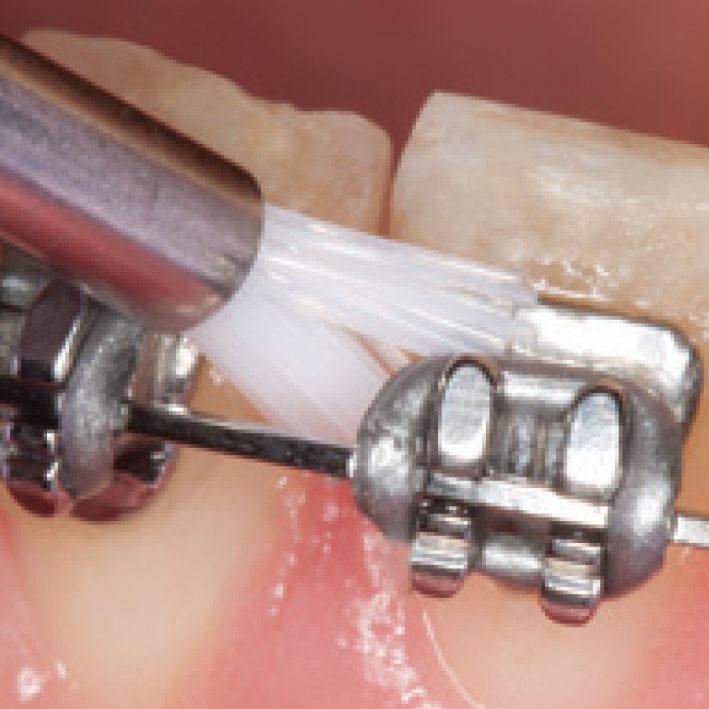 Mua Chổi Làm Sạch Các Vùng Khó Vào Starbrush ️ VAT đầy đủ