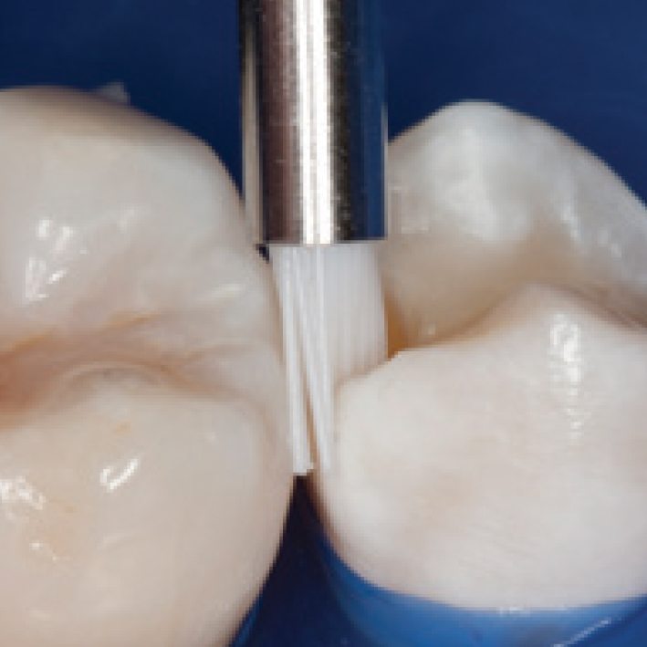 Mua Chổi Làm Sạch Các Vùng Khó Vào Starbrush ️ VAT đầy đủ