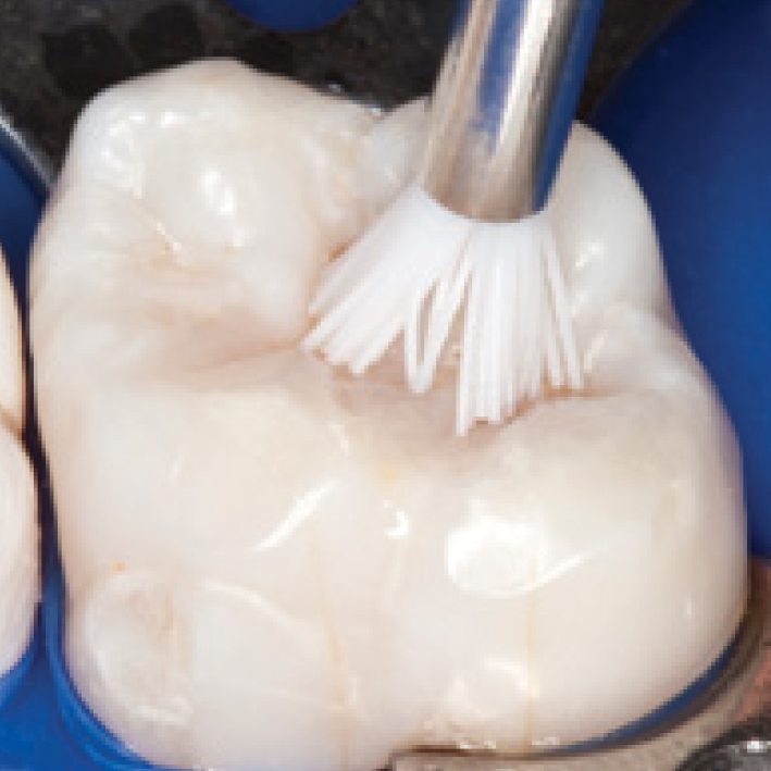 Mua Chổi Làm Sạch Các Vùng Khó Vào Starbrush ️ VAT đầy đủ