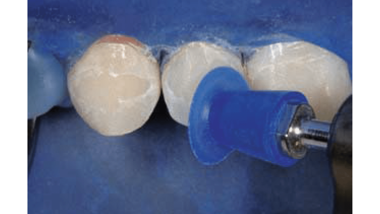 Flexipol | DOE Việt Nam