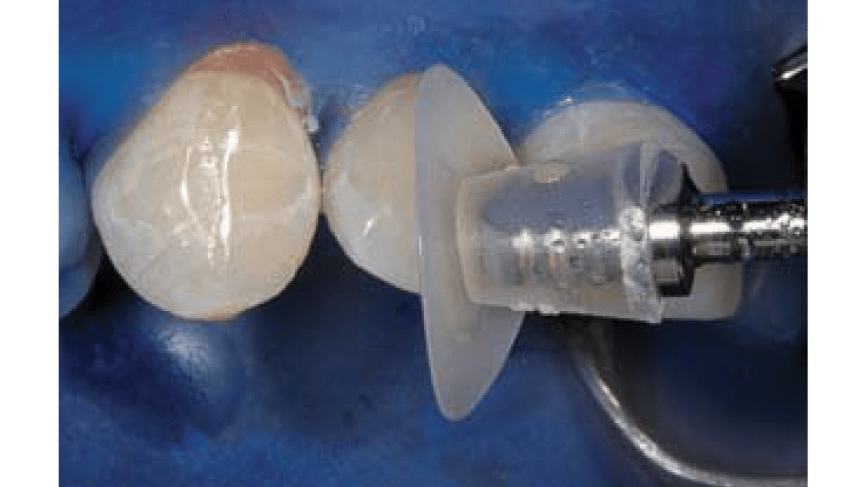 Flexipol | DOE Việt Nam