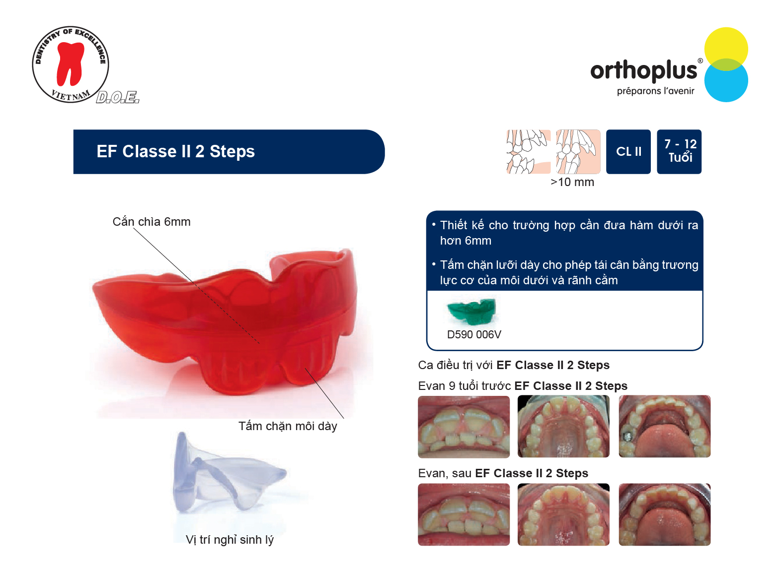 Khí cụ chức năng dành cho trẻ em và phương pháp điều trị hiệu quả - DOE ...