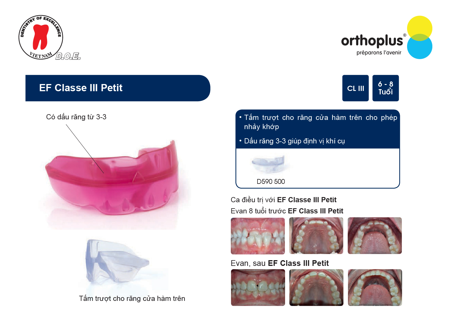 Khí cụ chức năng dành cho trẻ em và phương pháp điều trị hiệu quả - DOE ...